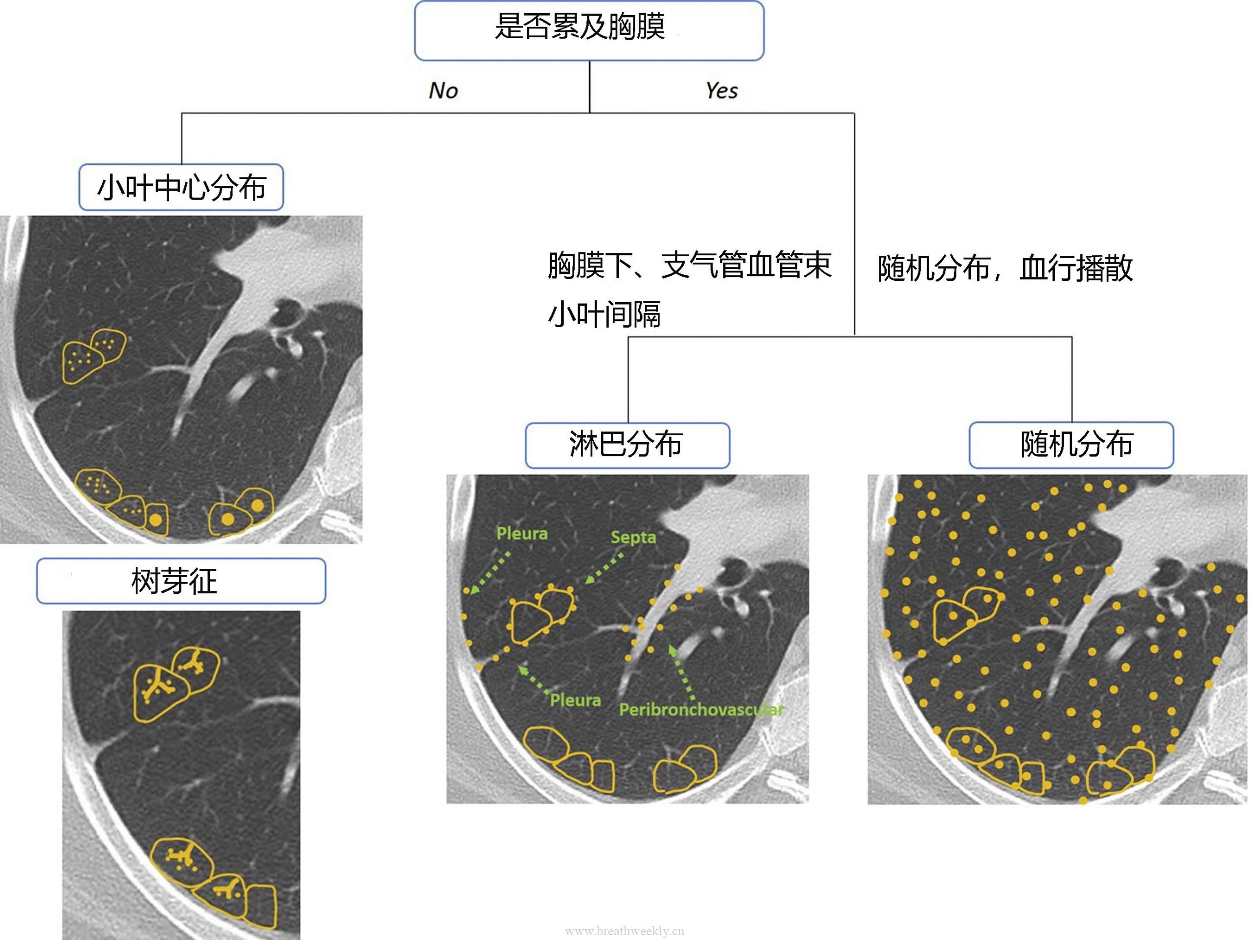 每周呼吸 | 一个专业的呼吸网站